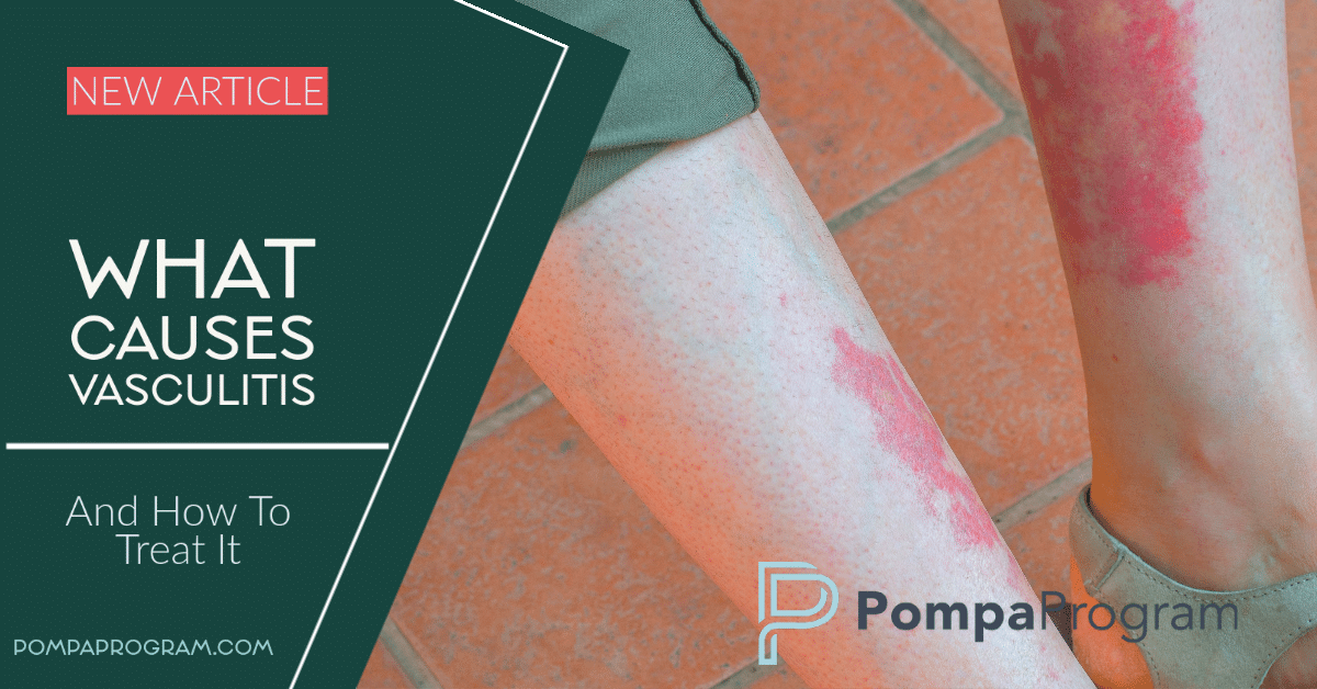 What Causes Vasculitis | Pompa Program