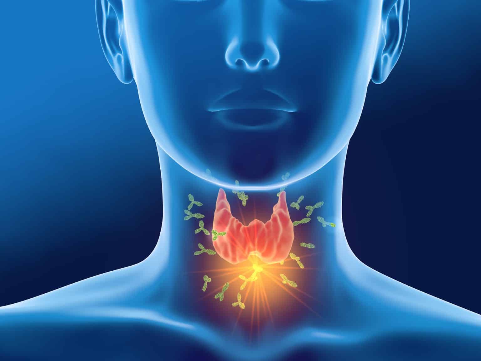 What Causes Thyroid Disease | Pompa Program