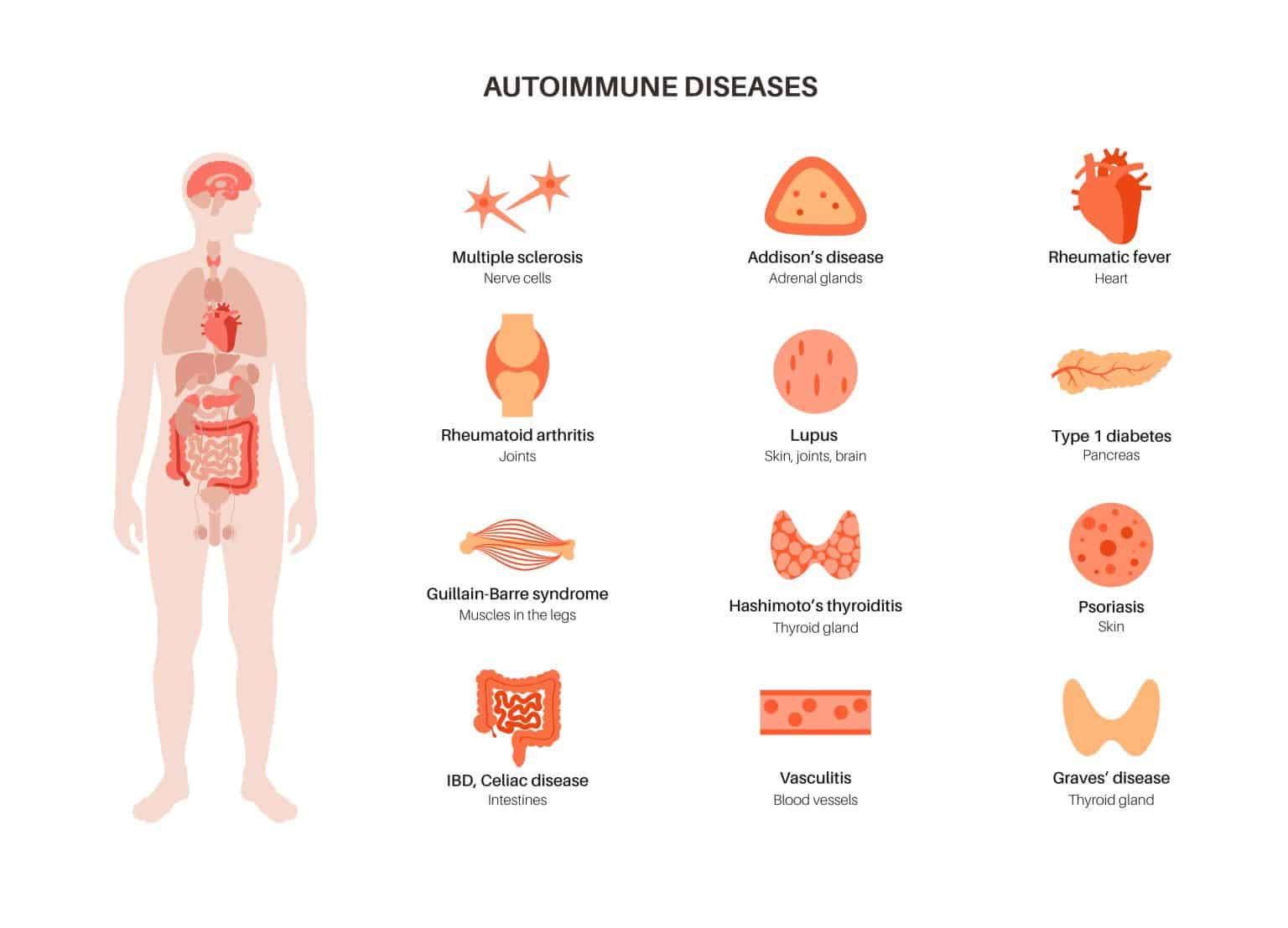 A Look At Autoimmune Diseases | Pompa Program