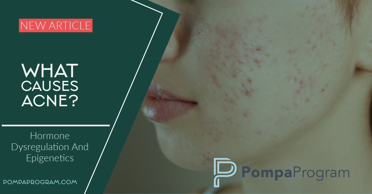 What Causes Acne | Pompa Program