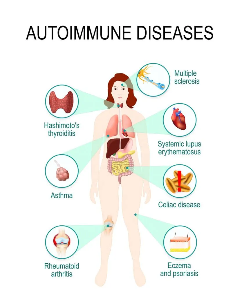 What Causes Autoimmune Conditions? | Pompa Program Masterclass